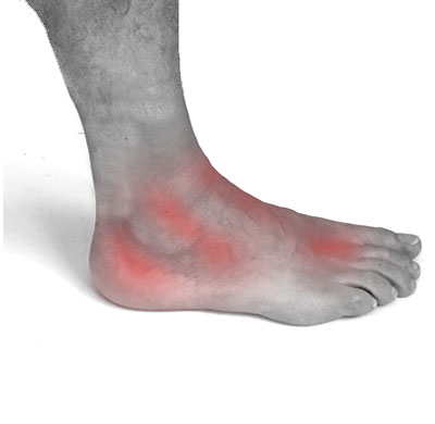 Voetklachten, hielspoor en rugpijn? Dekos heeft de oplossing | Dekos.nl ...